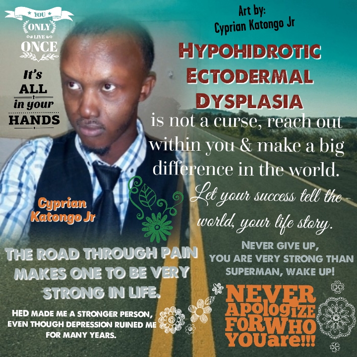 We Should Love Our Lives - National Foundation for Ectodermal Dysplasias