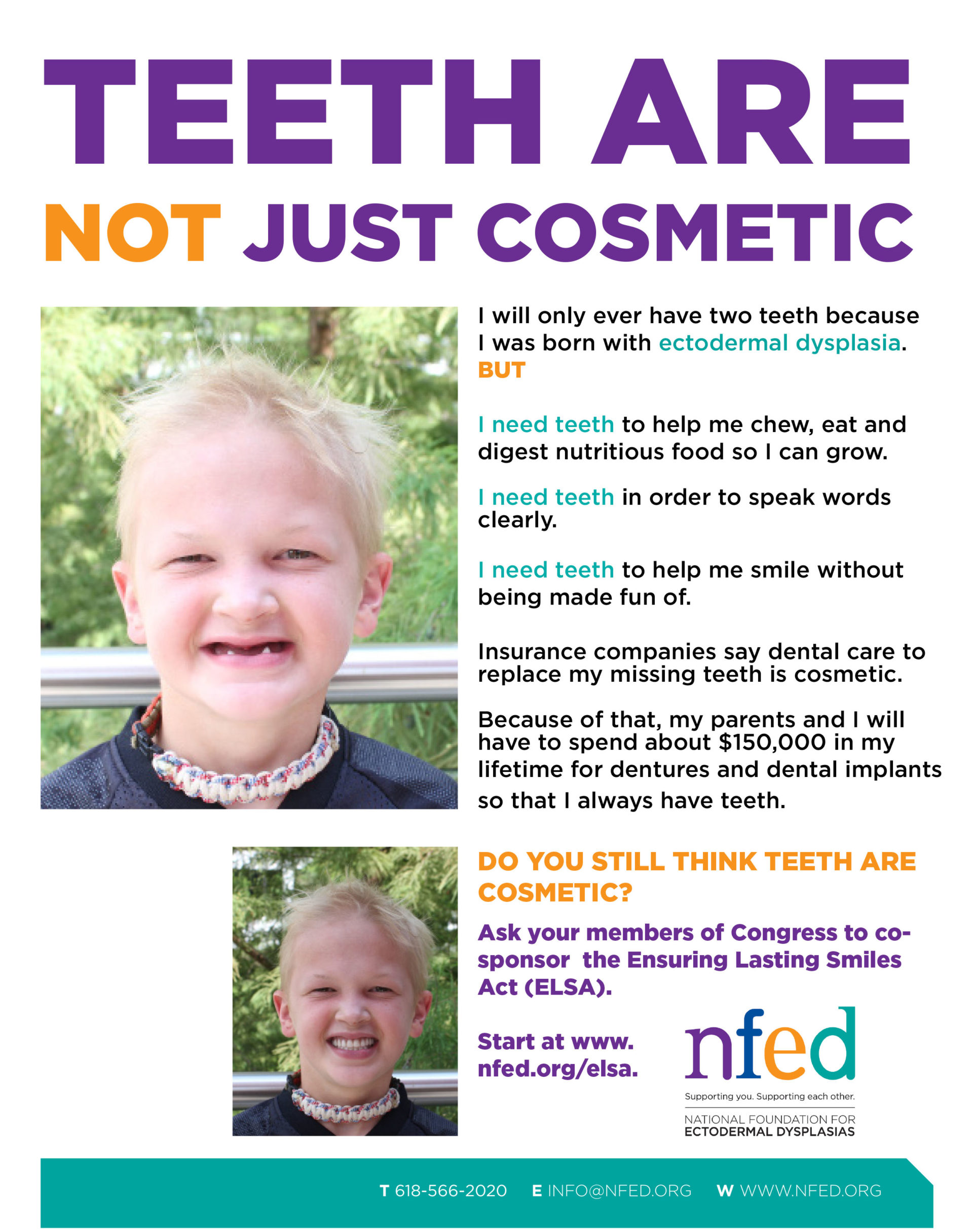 Ectodermal Dysplasias Awareness Month 2019 - NFED