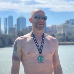 National Foundation for Ectodermal Dysplasias | NFED